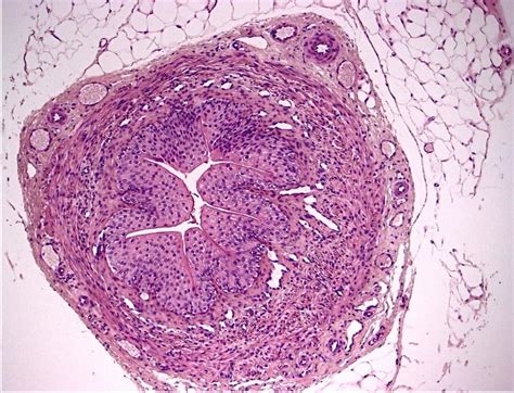Stratified Transitional Epithelium Diagram Quizlet