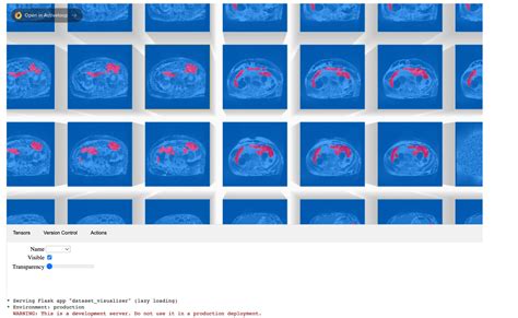 Radiology Machine Learning Multi Image Segmentation With Transunet