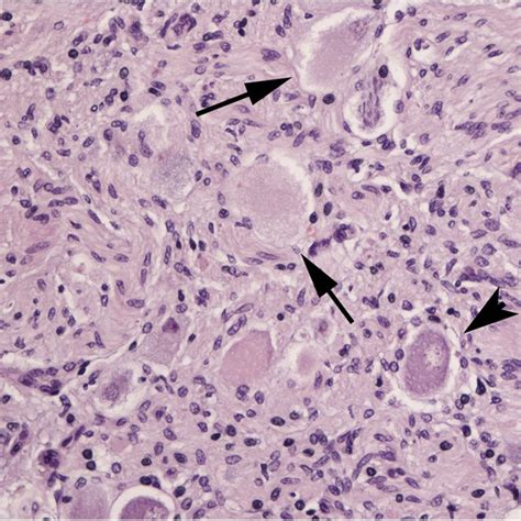 Case 1 Cranial Mesenteric Ganglion A Number Of Ganglion Cells Consist