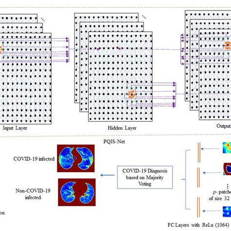 A Parallel Quantum Inspired Self Supervised Network Pqis Net Assisted