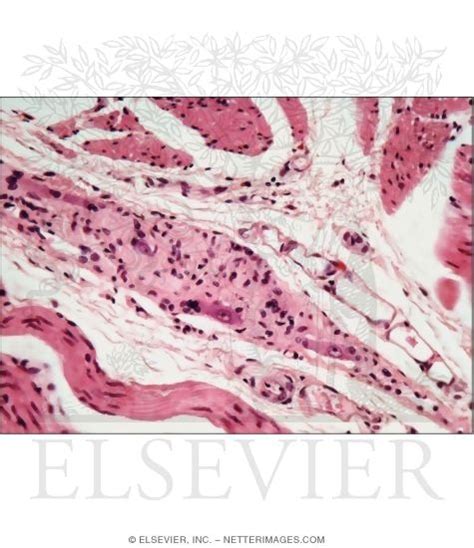 Light Micrograph Of A Myenteric Plexus In The Muscularis Externa Of The Esophagus