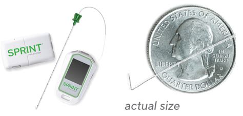 Sprint Pns System Optim Health System
