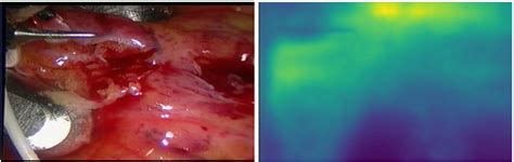 Neural Radiance Fields For Novel View Synthesis In Monocular Gastroscopy Ai Research Paper Details