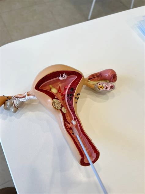 자궁경부암 검진 국가 무료검사만으로는 부족할까요 네이버 블로그