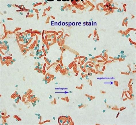 Microbiology Lab Endospore And Acid Fast Staining Flashcards Quizlet