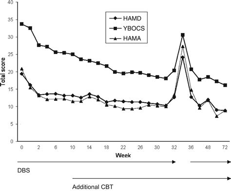 Cognitive Behavioural Therapy Augments The Effects Of Deep Brain Stimulation In Obsessive