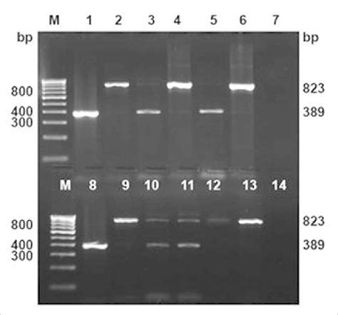 Species Differentiation Of Mycobacterium Tb Mtb Complex Members In Download Scientific