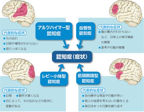 疾患チェック 認知症 神門鍼灸整骨院 甲子園院