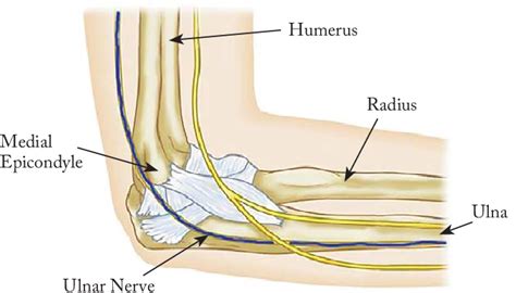 Ulnar Nerve Entrapment At The Elbow Download Scientific Diagram