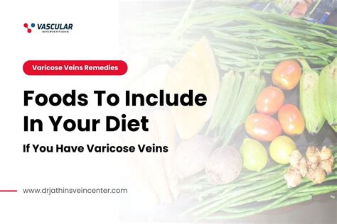 Foods To Include In Your Diet If You Have Varicose Veins Dr Jathins Vein Center