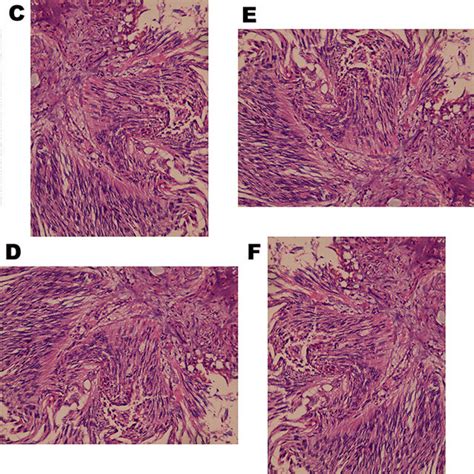 An Example Of Image Augmentation By Rotation And Flipping An Example