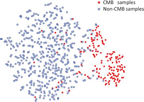 Figure 5 From Automatic Cerebral Microbleeds Detection From Mr Images