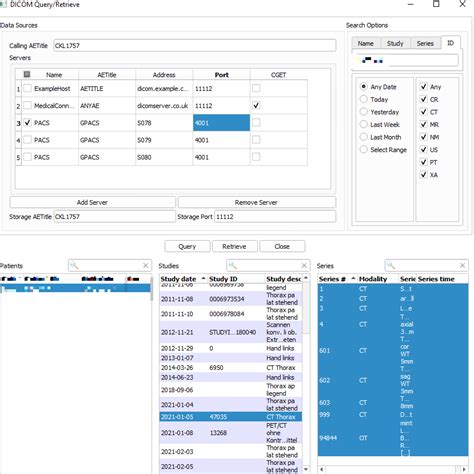 Load Dicom Data Via Networking With Python Script Support 3d Slicer Community