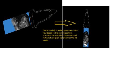 Rotating An Image To Align With The 2d Projection Of The 3d Model Support 3d Slicer Community