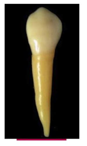 Mandibular Premolar Flashcards Quizlet