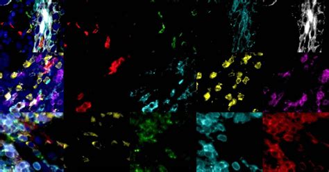 Selectscience® On Linkedin How To Unlock The Complexity Of Tumor