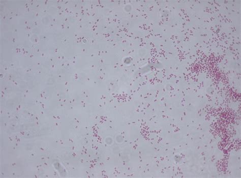 Gram Negative Bacilli Rods Microbiology Learning The Whyology Of
