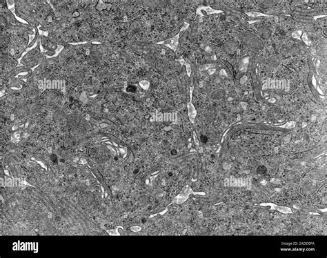 Transmission Electron Micrograph Tem Showing Chylomicrons