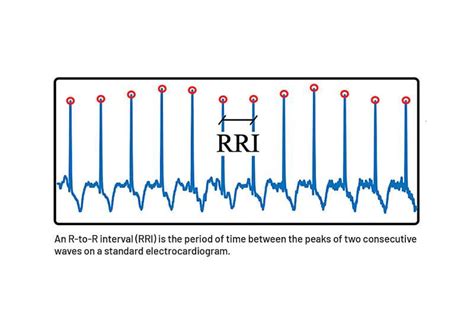 Predicting Cardiac Arrhythmia 30 Minutes Before It Happens