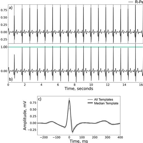 Pdf Towards Understanding Ecg Rhythm Classification Using Convolutional Neural Networks And