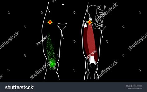 Trigger Point Rectus Femoris Muscle Musculus Stock Vector Royalty Free