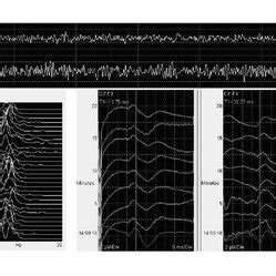 Screenshot Of Continuous EEG Spectral EEG Analysis And SSEPs