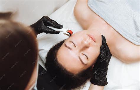 Premium Photo Mesotherapy Using Microneedles Facial Rejuvenation And