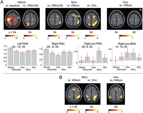 A Regional Differentiation Within The Dorsal Premotor Cortex