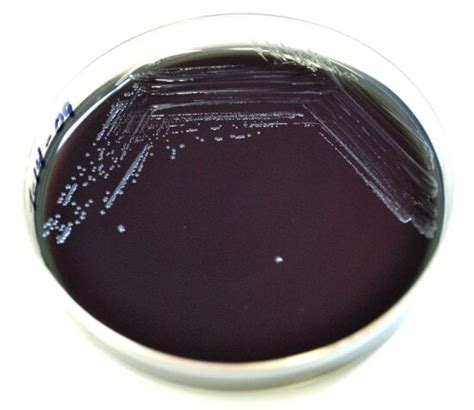 Free Picture Gram Negative Francisella Tularensis Bacteria Grown