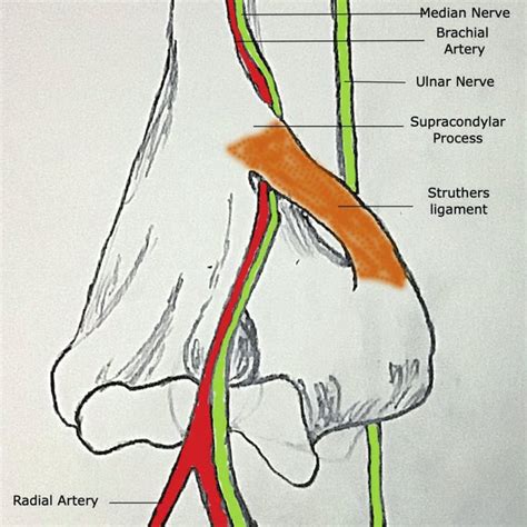 Brachial Plexus Formation Roots Trunks Divisions And Cords Of The Download Scientific Brachial Plexus Formation Roots Trunks Divisions And Cords Of The Download Scientific