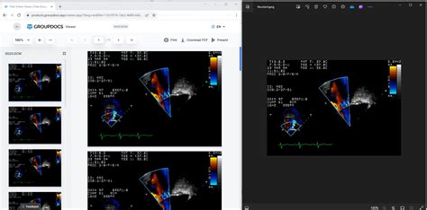 C تبدیل Dcm به  تبدیل Dicom به Jpeg در Cnet