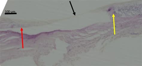 Histo Photograph Showing An Inner Limiting Membrane Ilm Defect Download Scientific Diagram
