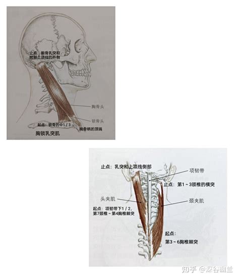 侧屈颈痛的调理 知乎