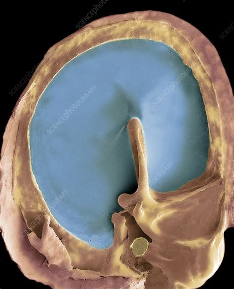 Eardrum Sem Stock Image C0550657 Science Photo Library