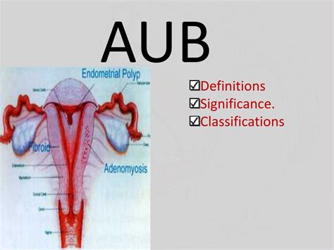 PPT AUB PowerPoint Presentation Free Download ID 9543767