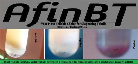 Novel Biochemical Test For Illnesses Of Bacterial Origin Download