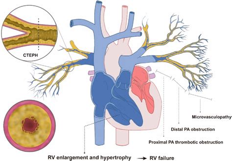 Clinical Presentations And Multimodal Imaging Diagnosis In Chronic