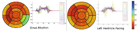 Patient Contraction Force Prediction Predicted Contraction Force Time