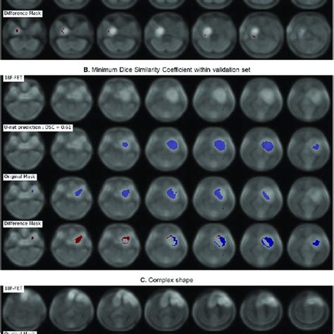 Segmentation Examples With For Each Example Original Resized Slices 18