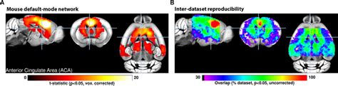 A A Seed Based Analysis Of The Anterior Cingulate Area In 98