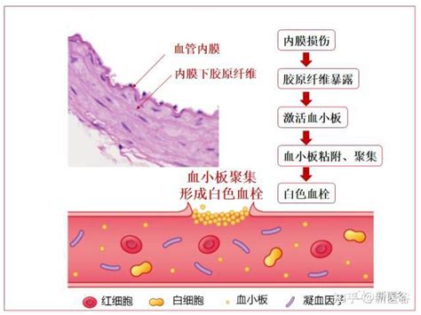 出血如何止？解析止血那些事 生理止血 知乎