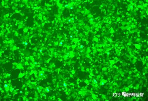 稳转细胞系构建 知乎