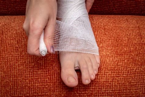 Bandaged Legs Of A Girl On The Beach Who Suffered A Motorcycle Accident On A Road In Thailand
