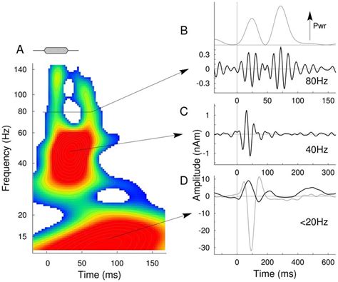 Overview Of The Types Of Auditory Evoked Responses A The