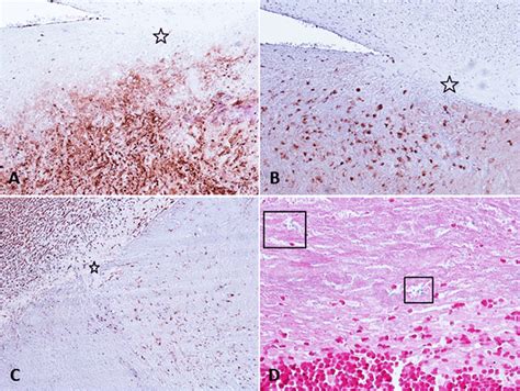 Ihc With Anti Cd15 A Anti Cd68 B Anti Sma C And Perls Download Scientific Diagram