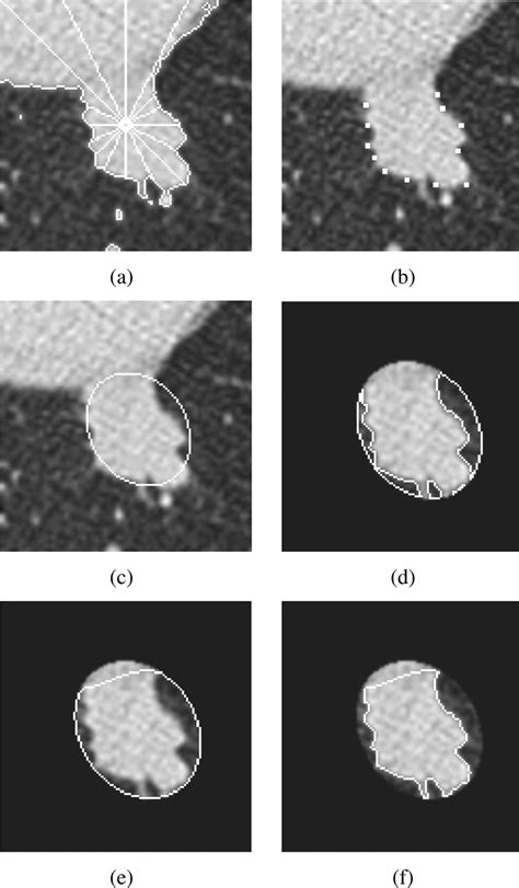 Step By Step Illustration Of The Segmentation Algorithm For Download Scientific Diagram