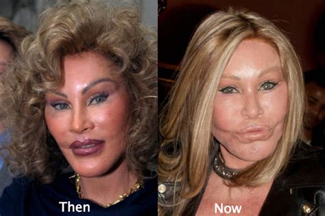 Jocelyn Wildenstein Before And After Plastic Surgery
