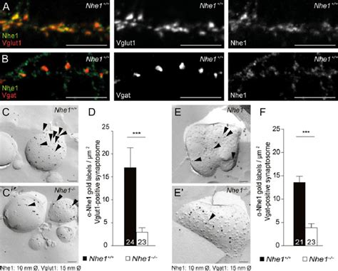 Nhe1 Localizes To Both Inhibitory And Excitatory Synapses A B