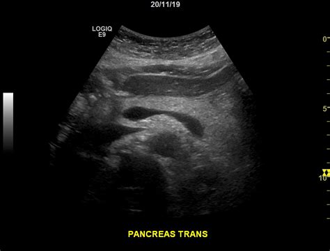 ‘the Pancreas” Integrated Ultrasound Education