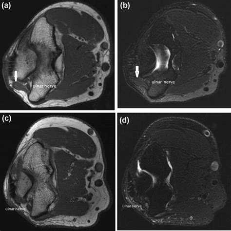 Measurement Of Craniocaudal A Transverse B Anteroposterior C In Download Scientific